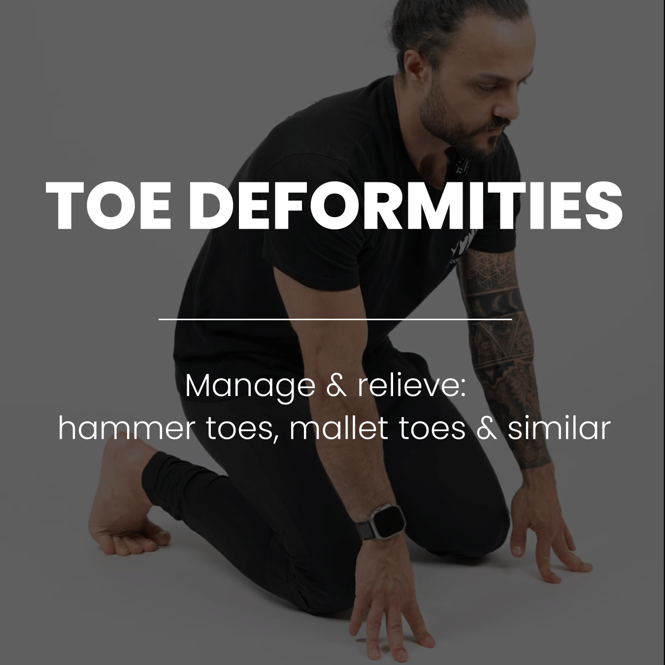 Toe Deformities – My Foot Function