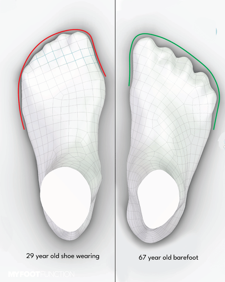 The Shoe Effect – My Foot Function