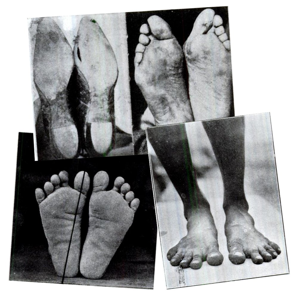 The Shoe Effect - My Foot Function